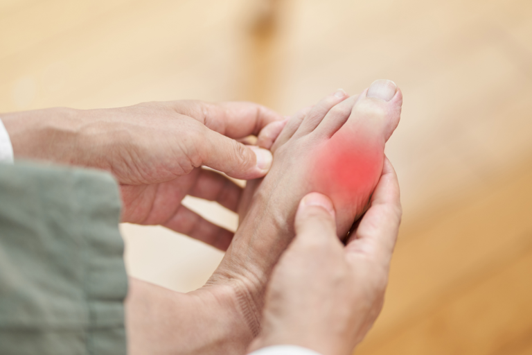 Gout vs Arthritis: Understanding the Differences - Austin, Texas